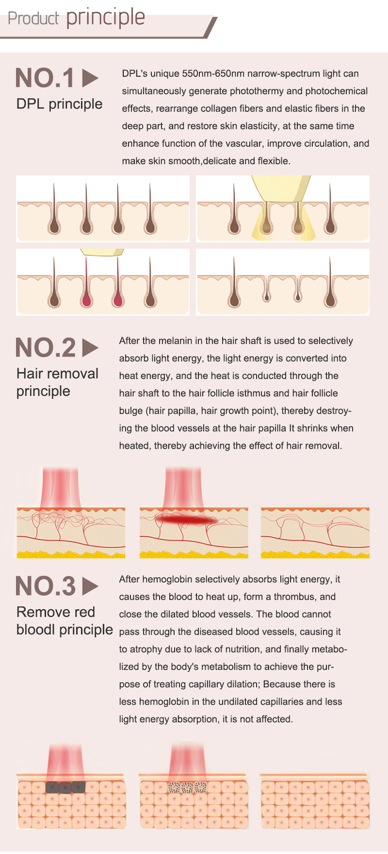 Dpl Hair Removal Skin Rejuvenation Multifunction Machine - Buy dpl ...